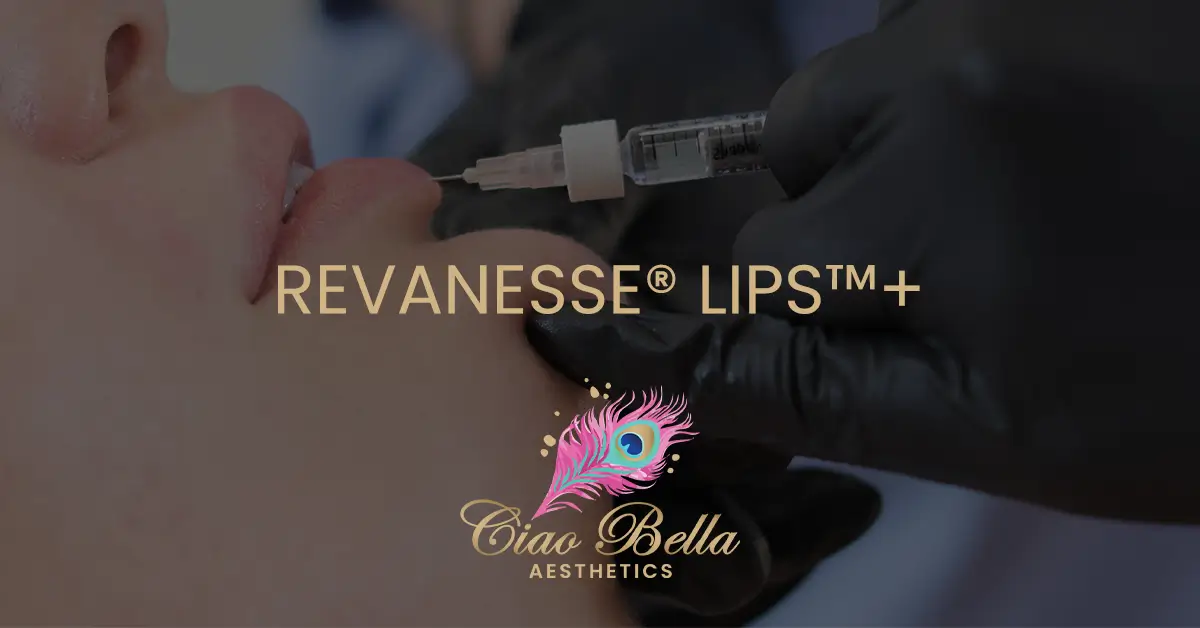 Lip Fillers - Revanesse® Lips™+ - Ciao Bella Aesthetics